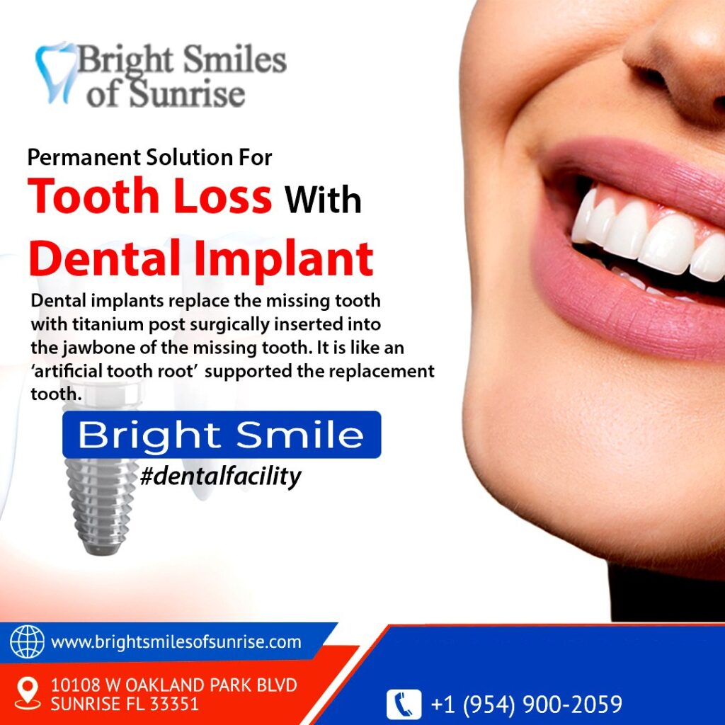 Permanent solution for tooth loss with Dental Implant | Dentist Oakland ...